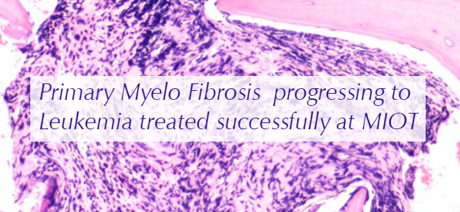 Primary Myelo Fibrosis progressing to Leukemia treated successfully at ...
