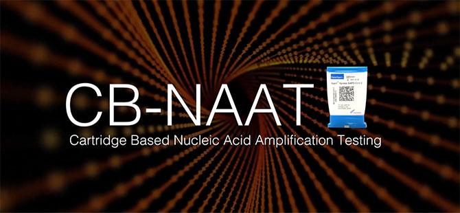 MIOT Hospitals takes COVID-19 testing to a whole new level with CB-NAAT ...