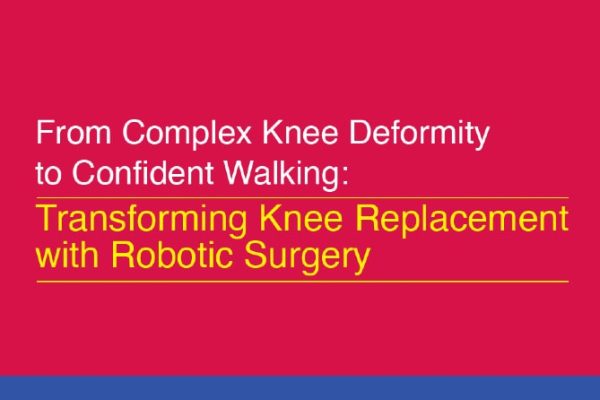 Robotic Knee Replacement for Severe Deformity at MIOT International